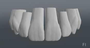 3D Files (STL and EXOCAD) - Anteriores Templates