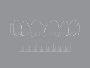 F30 Symmetrical Contour - Anteriores Templates
